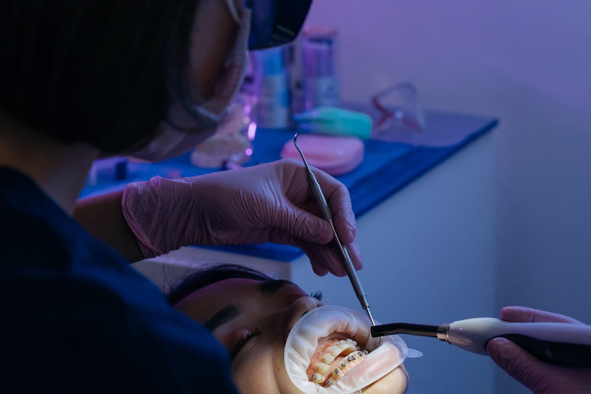 Wisdom Teeth Extraction Aftercare: Complete Recovery Guide and Timeline ...
